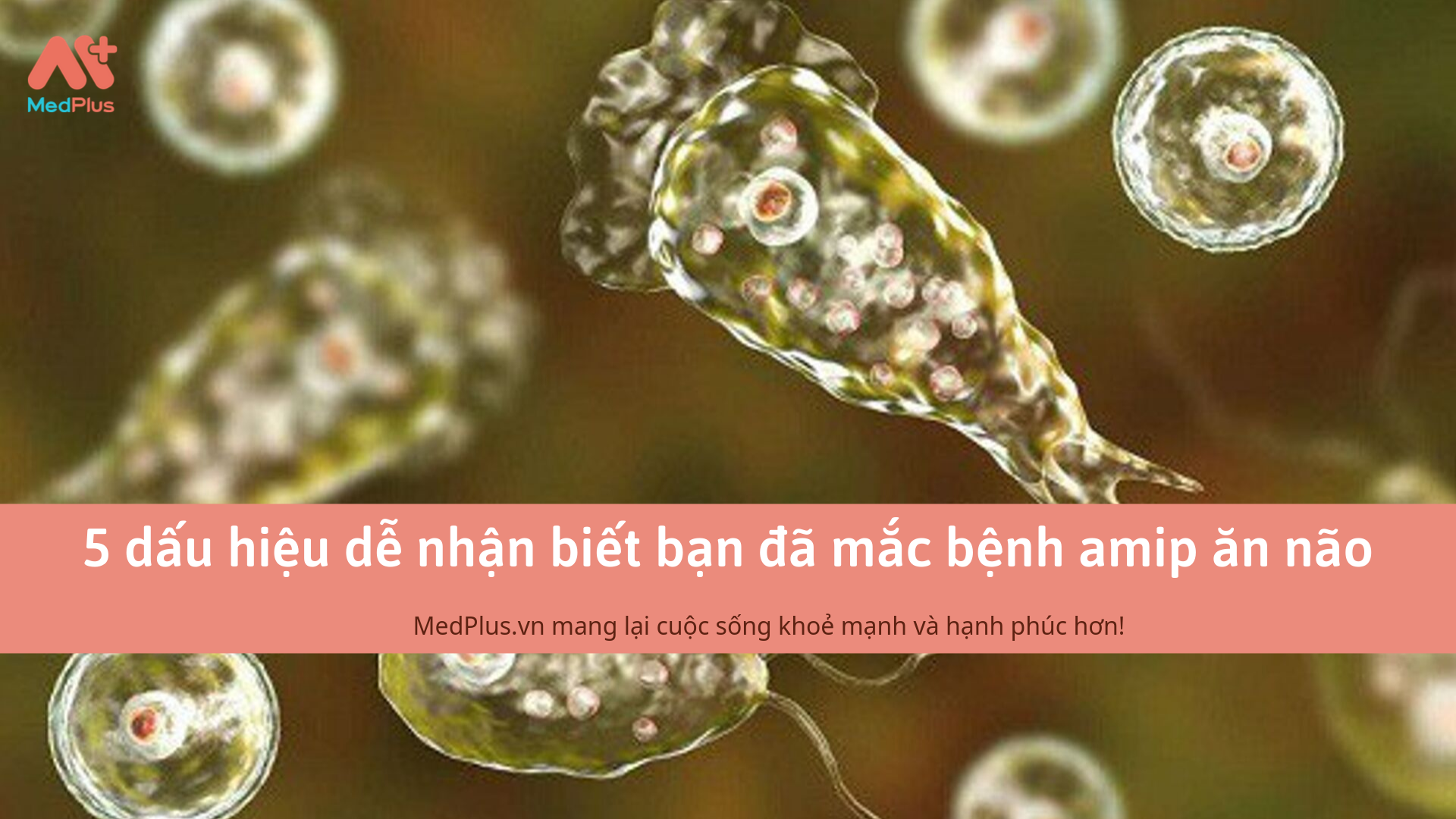 5 dấu hiệu dễ nhận biết bạn đã mắc bệnh amip ăn não - Medplus.vn