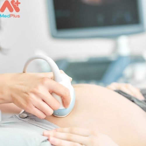 7 điều về THỂ TAM BỘI của thai nhi, bạn có biết?